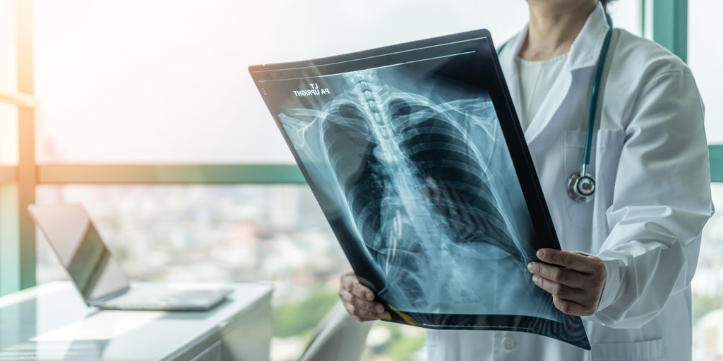 How Do I Know If I Need An X Ray Oxford Urgent Care